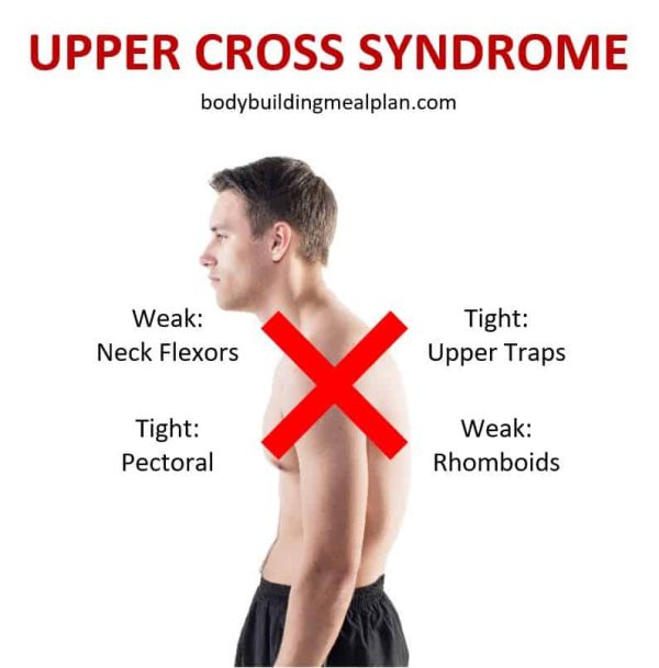 Upper Cross Syndrome Exercises to Fix Posture & Pain
